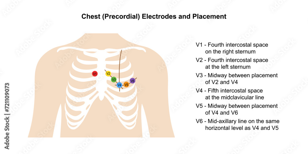 Electrocardiogram. Chest (Precordial) Electrodes and Placement with ...