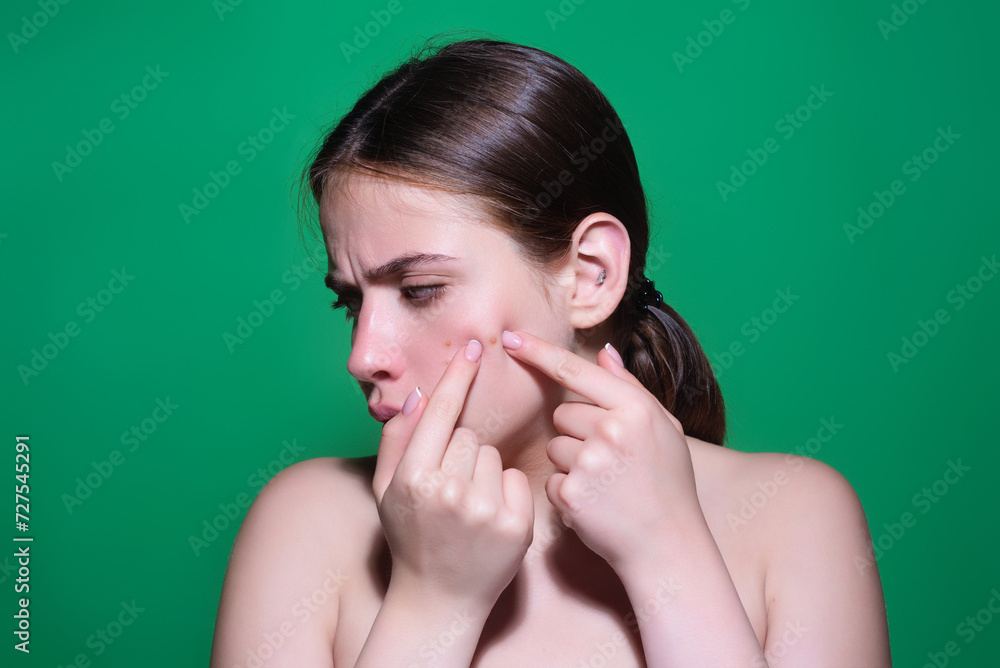 Photo Stock Sad Woman squeeze out pimples on cheek. Acne and pimple on ...
