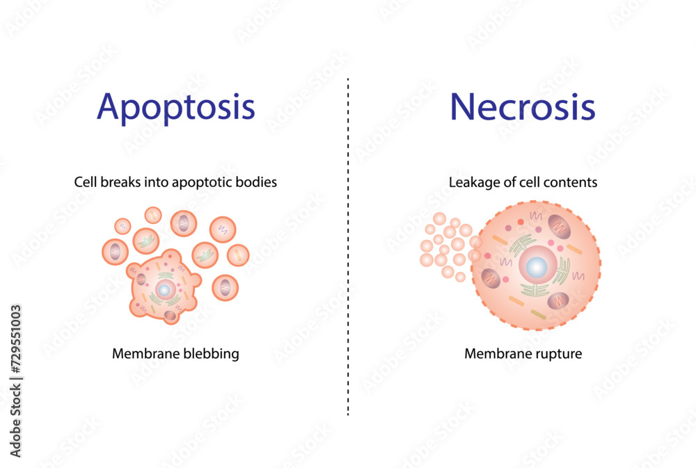 Necrosis and apoptosis of normal cell. Cell death types. Labeled ...