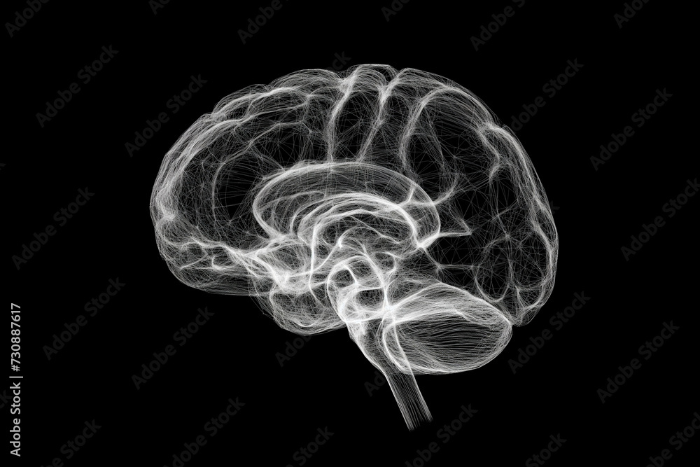 X-ray scan of the human brain on a white background with a black ...