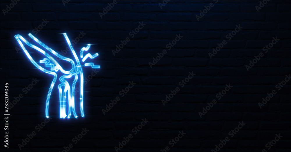 Kneecap Replacement (Patellofemoral Replacement) procedure involves ...