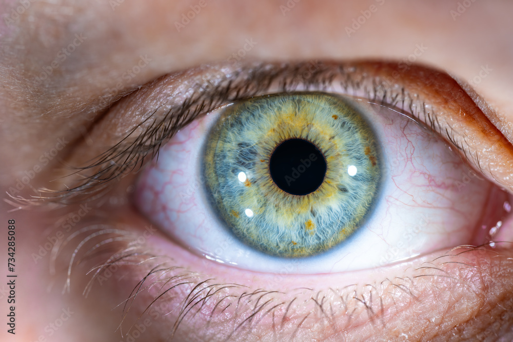 Female Blue-Green Colored Eye with brown pigment spots. Pupil Closed ...