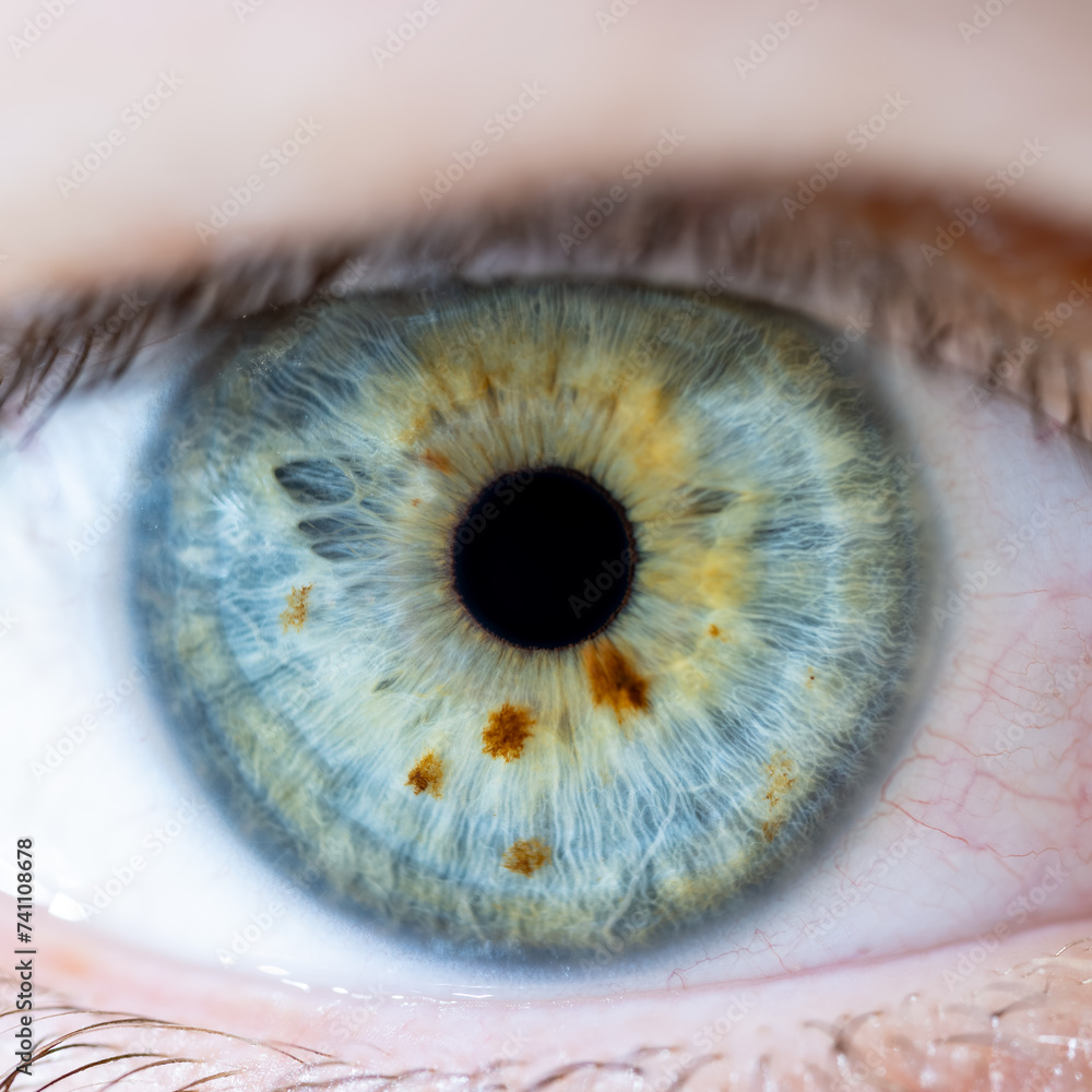 Foto de Stock Female Blue-Green Colored Eye with brown pigment spots ...