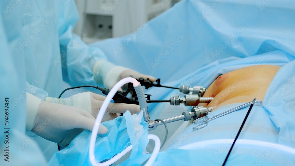 Hands of surgeons with the help of endoscopic equipment and instruments ...