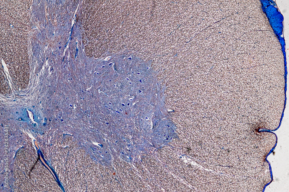 Histological Cerebellum human, Sympathetic ganglion human And Spinal ...