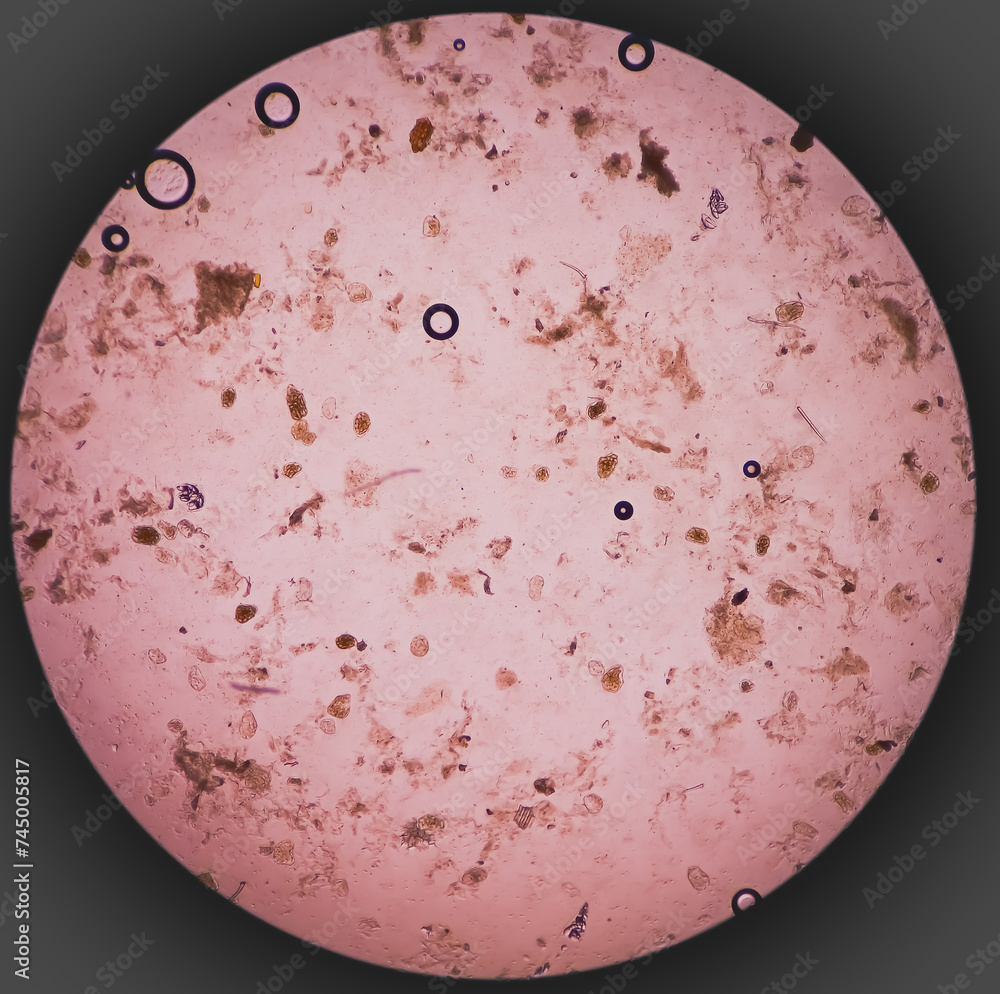 Giardia lamblia cysts and Trophozoite form, muscle fiber in stool ...
