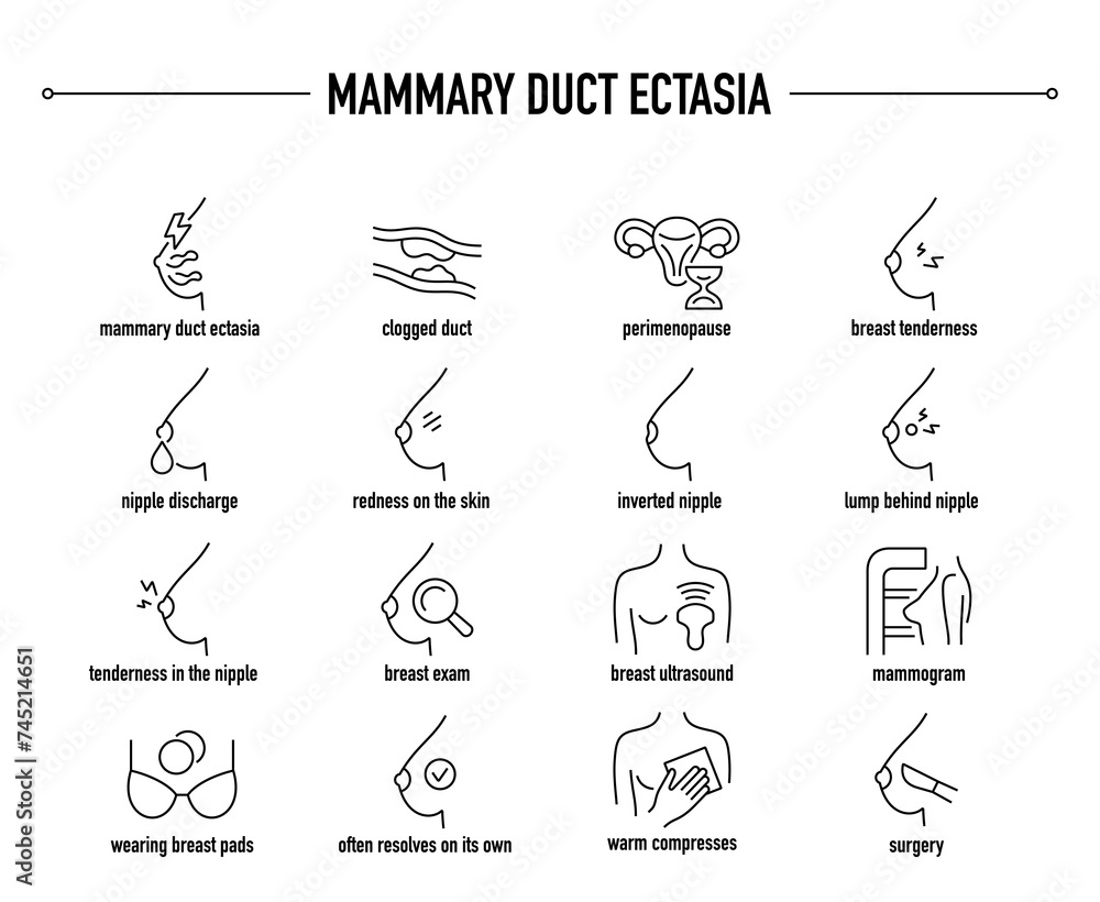 Mammary Duct Ectasia symptoms, diagnostic and treatment vector icons ...