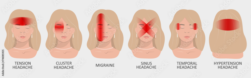 Vector illustration of a girl having a headache. Localization and types ...