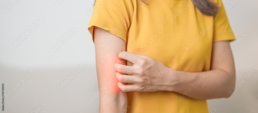 Stock-Foto „woman itching and scratching itchy arm. Sensitive Skin ...