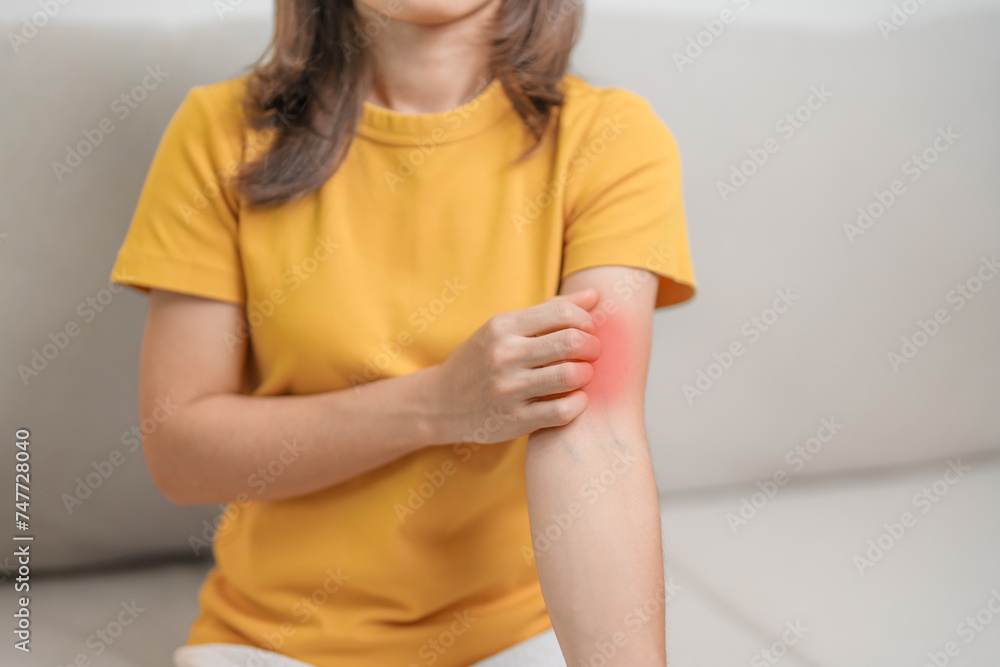 woman itching and scratching itchy arm. Sensitive Skin Allergic ...
