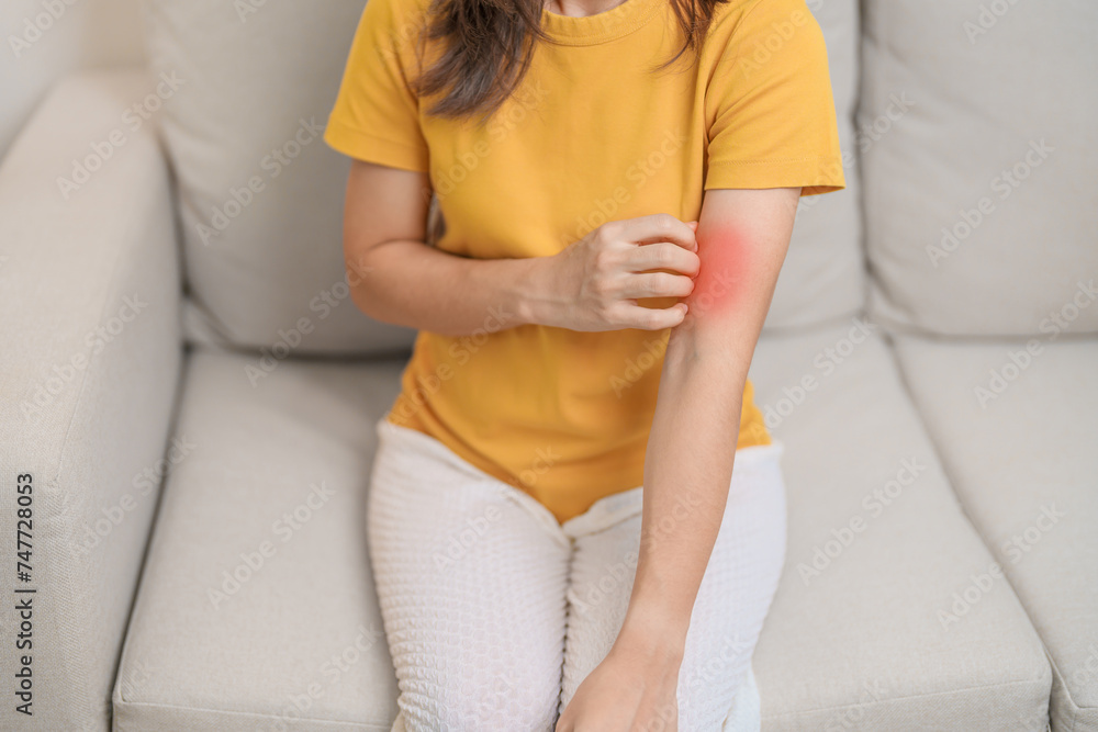 woman itching and scratching itchy arm. Sensitive Skin Allergic ...