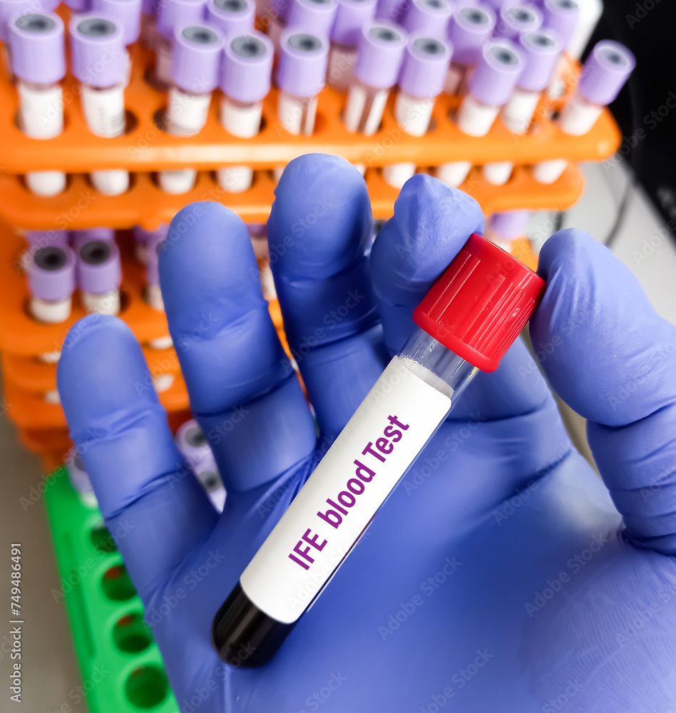 Blood sample for IFE (immunofixation electrophoresis) blood test, to ...