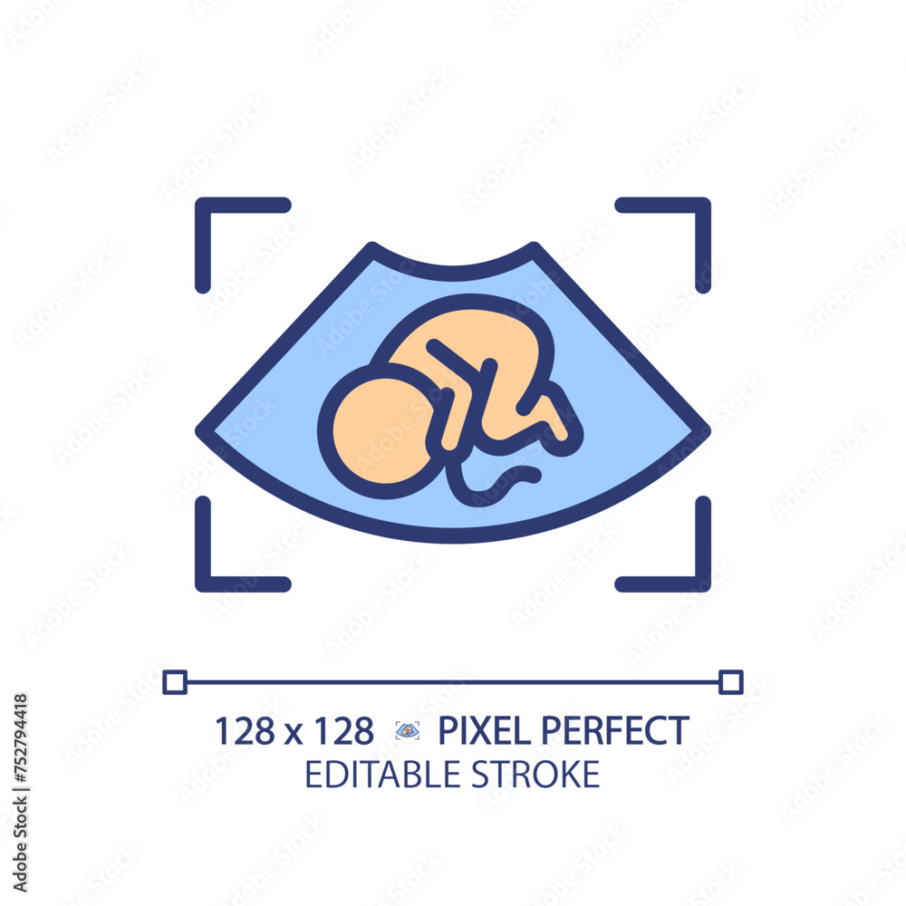 Prenatal ultrasound RGB color icon. Embryo medical examination. Baby ...