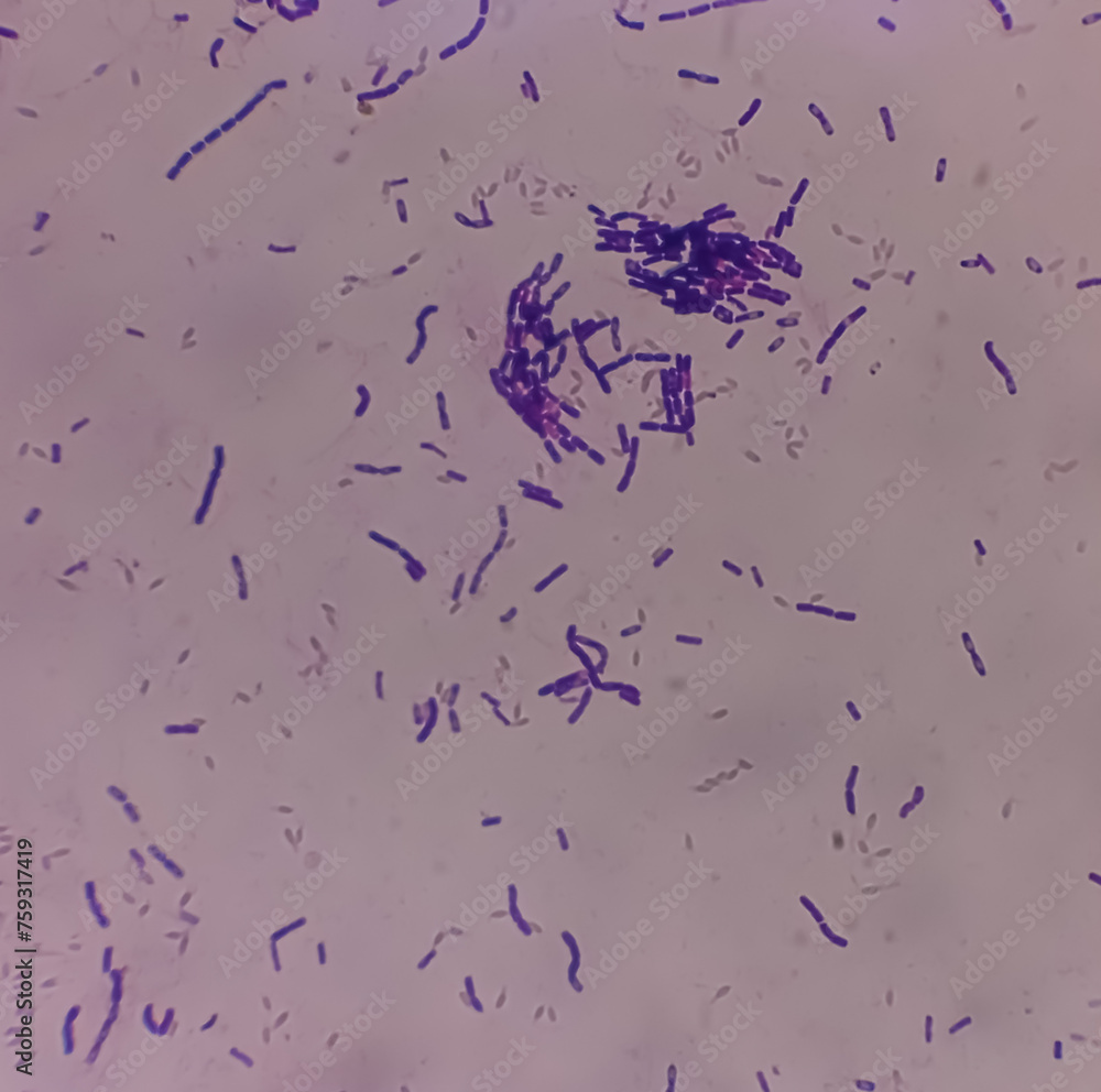 Yeast Infection; Budding yeast and pseudohyphae of Candida albicans ...
