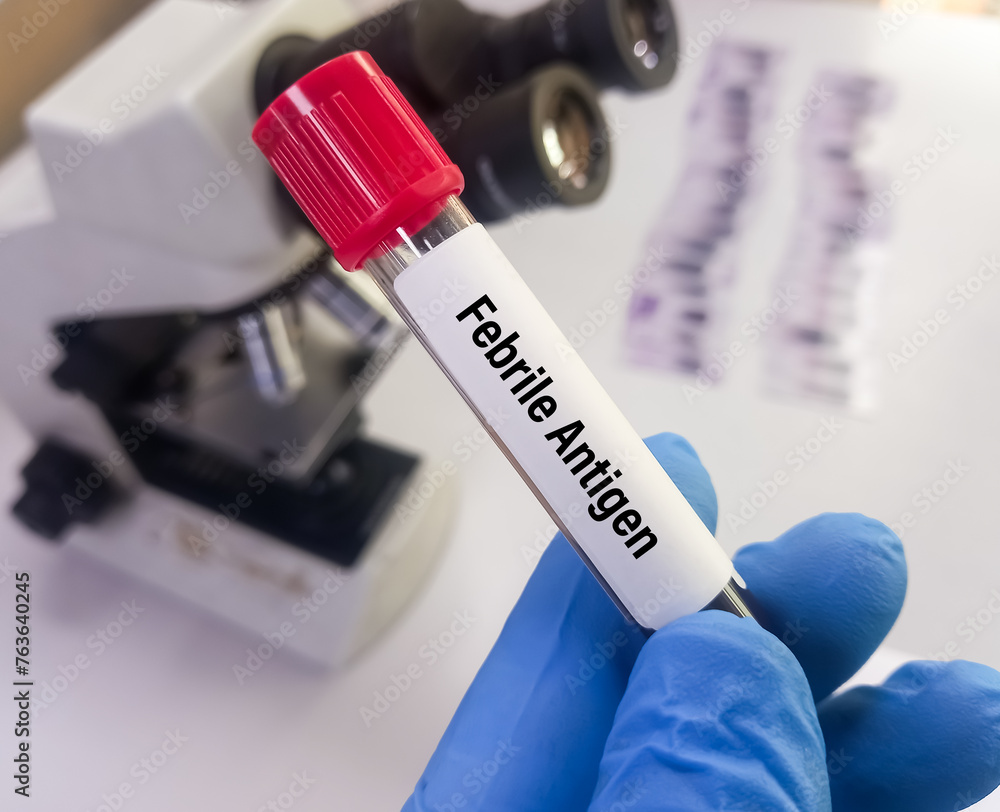 Blood sample for Triple antigen test, diagnosis of salmonellosis ...