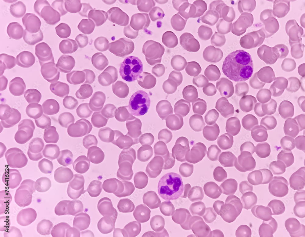 Foto de Stock Photomicrograph of hematological slide showing RBC, WBC ...