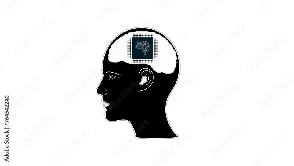 Human brain and computer chip, Head with implanted micro chip. Brain ...