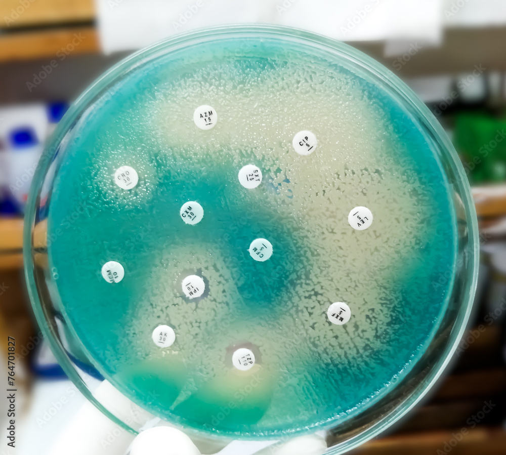 Antimicrobial susceptibility testing of Pseudomonas aeruginosa, mueller ...