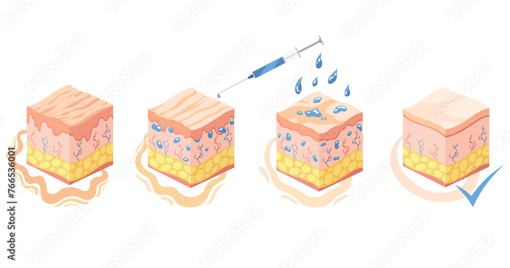 Hyaluronic acid isometric. Profile view cubes representing skin ...