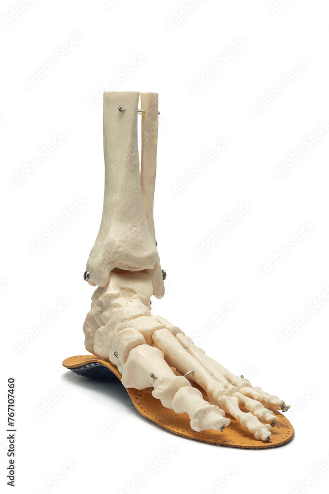 Anatomical model of human foot bones with orthopedic insole isolated on ...