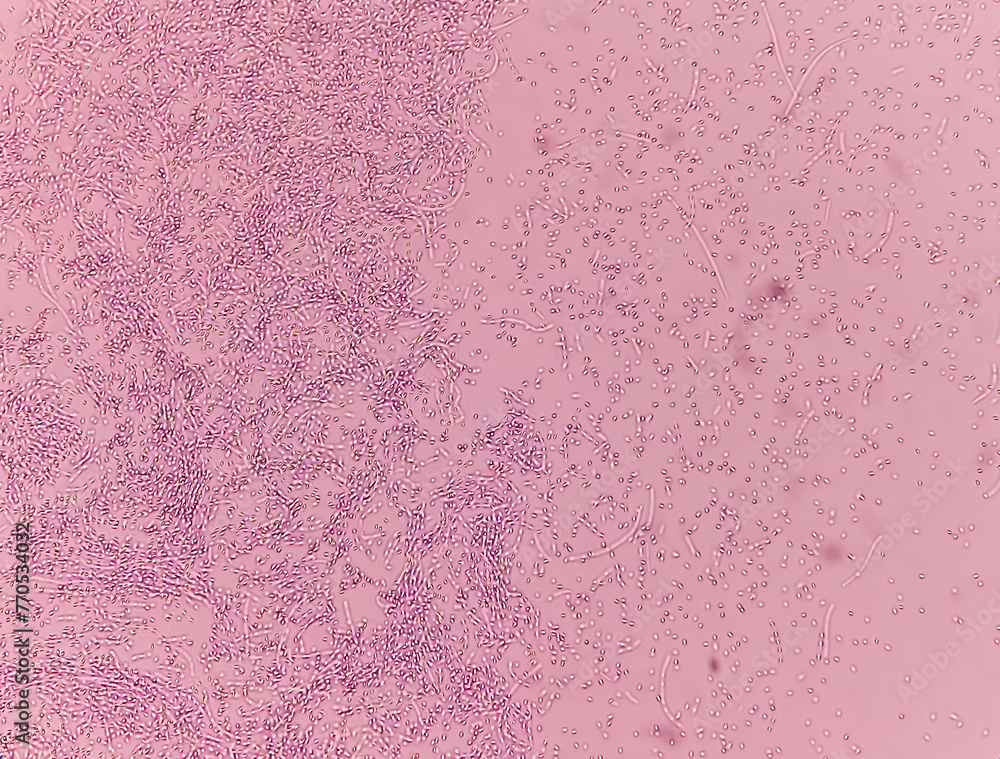 Microscopic image from fungus colonies at Sabouraud Dextrose Agar (SDA ...