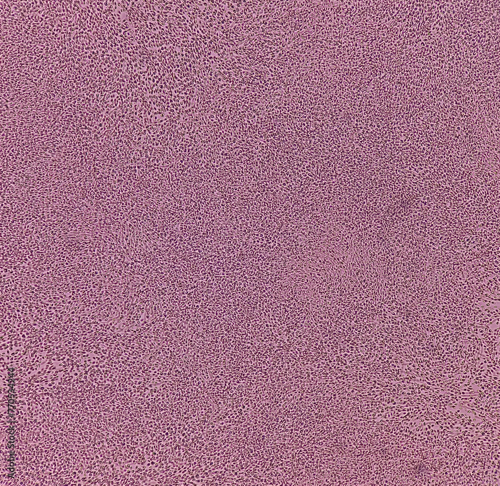 Microscopic image from fungus colonies at Sabouraud Dextrose Agar (SDA ...