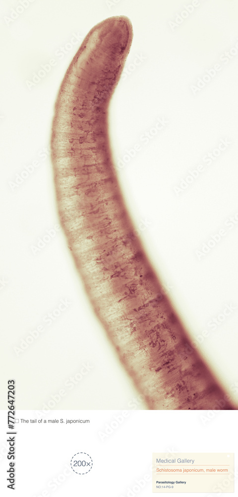 Schistosoma japonicum is a parasite that causes human schistosomiasis ...