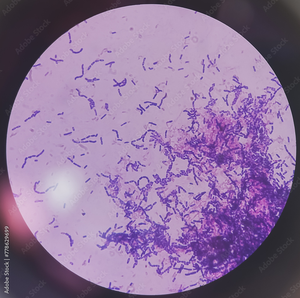 Yeast Infection; Budding yeast and pseudohyphae of Candida albicans ...