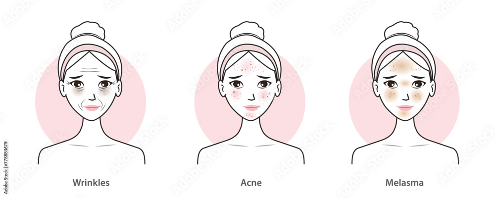 Infographic of skin problems set vector illustration isolated on white ...