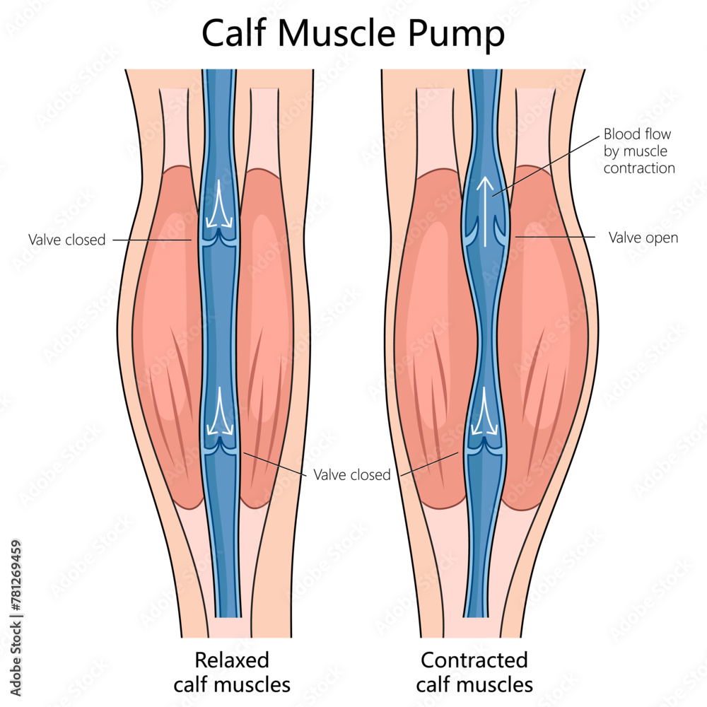 blood flow in relaxed and contracted calf muscles, indicating valve ...