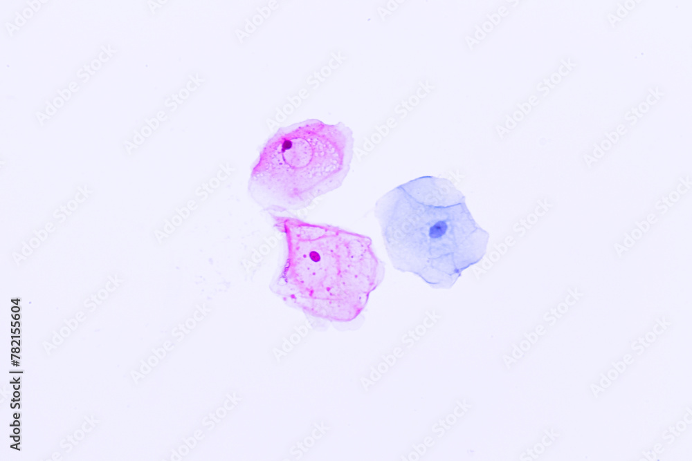 View in microscopic of human skin cells.Squamous epithelium cells ...