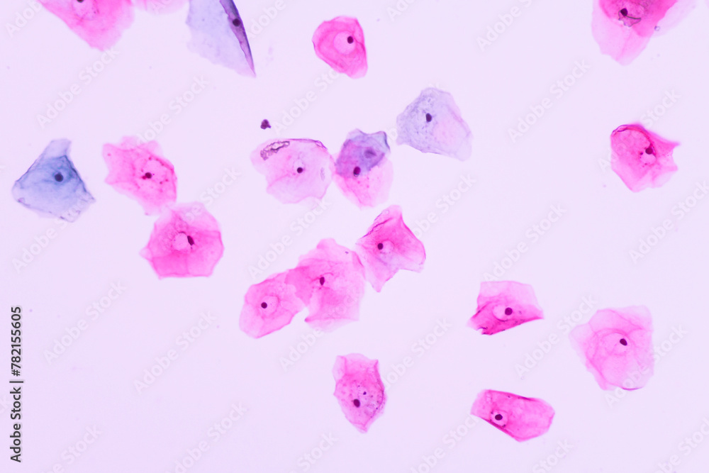 View in microscopic of human skin cells.Squamous epithelium cells ...