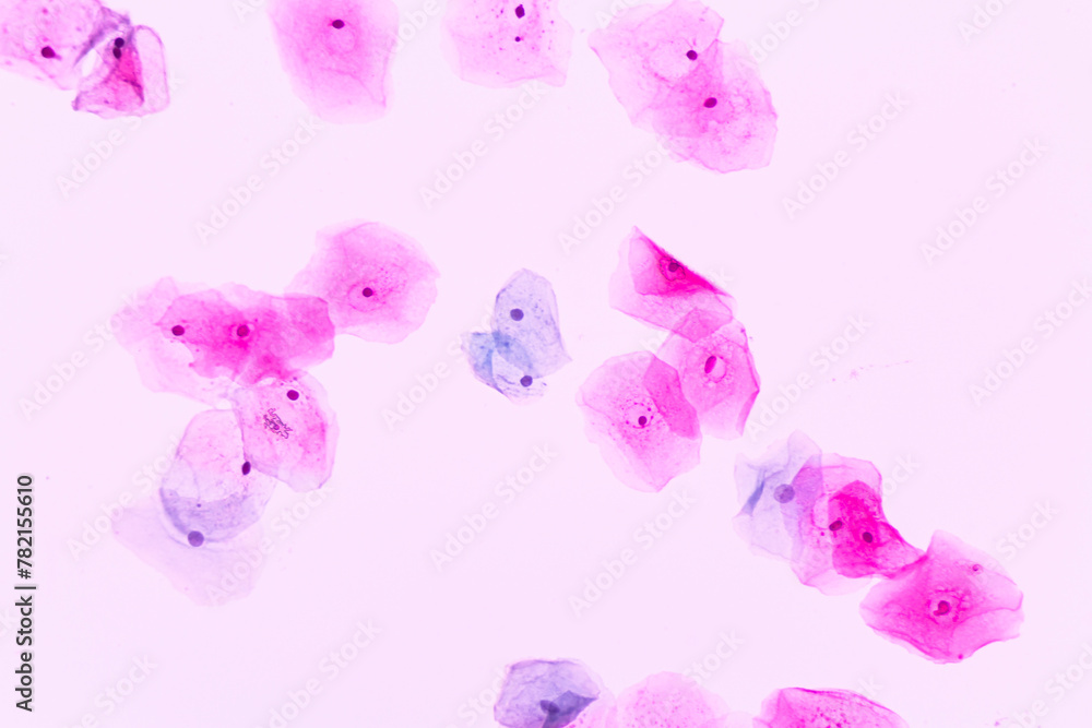 View in microscopic of human skin cells.Squamous epithelium cells ...