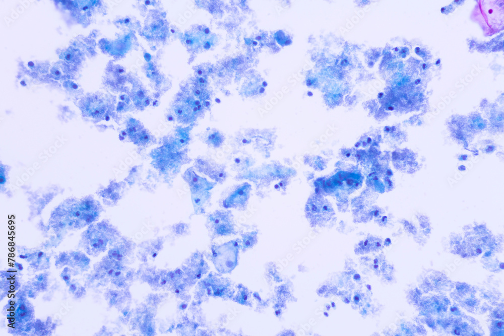 View in microscopic of human skin cells.Squamous epithelium cells ...