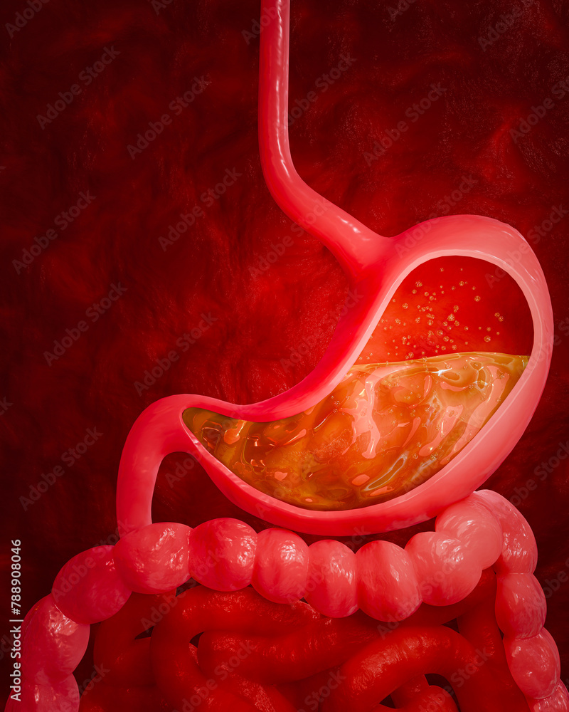 Symptoms of acid reflux or excess acid in the stomach. Gastric juice ...
