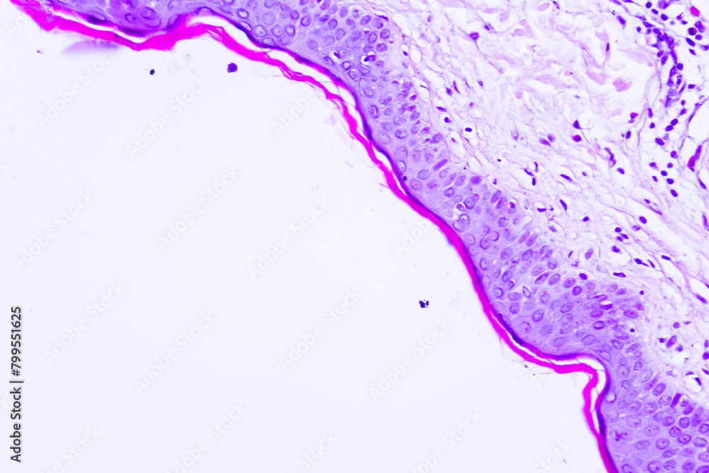 Backgrounds of human cells tissue of cervix under the microscope in ...