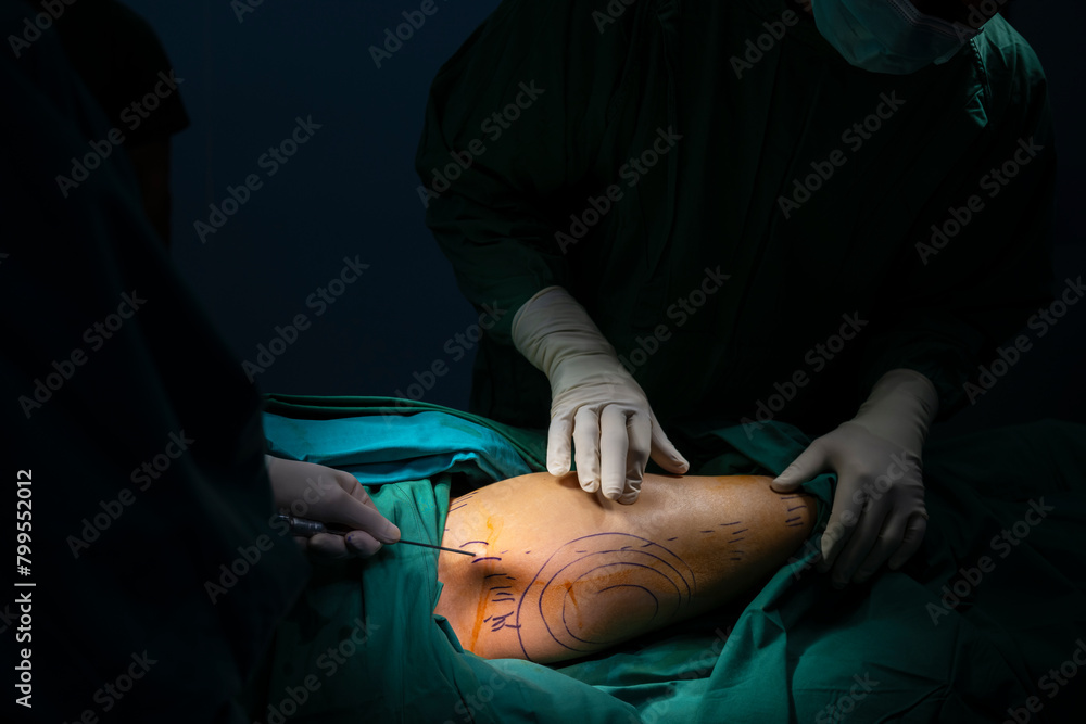 Female patient with marks on skin lying on medical bed while doctor ...