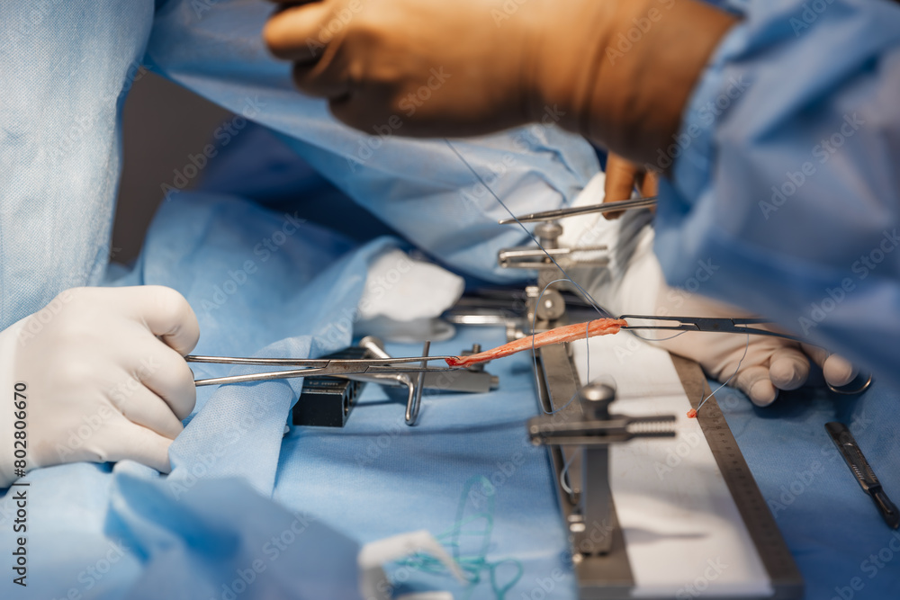 surgeons work on the cut part of the knee joint (muscular ligament ...
