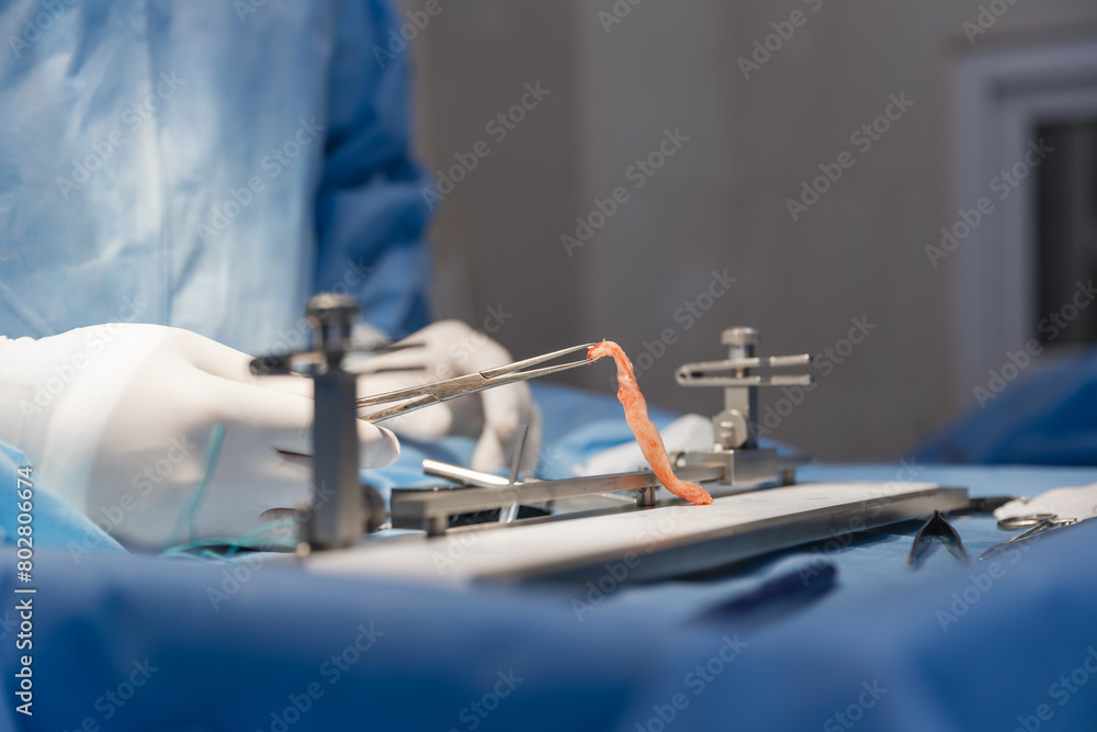 surgeons work on the cut part of the knee joint (muscular ligament ...