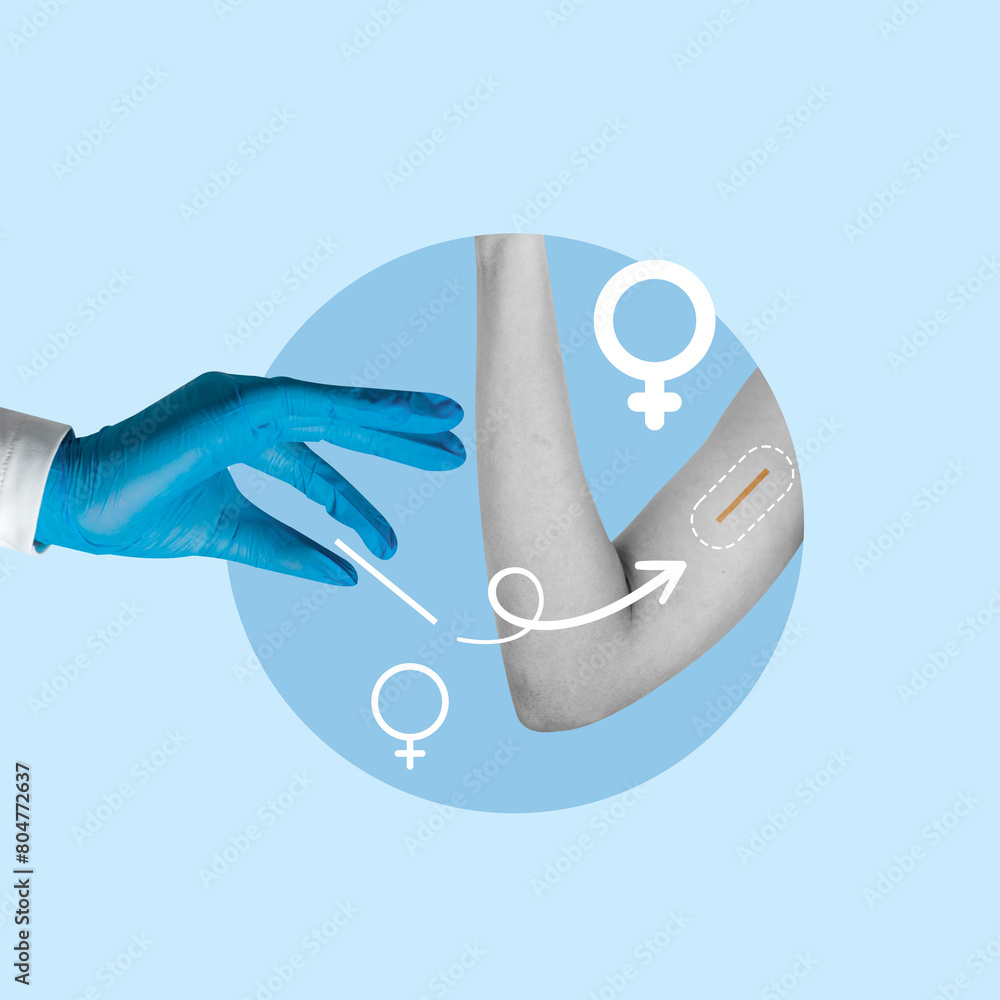 Contraceptive Implant, Contraceptive, Implant, Organization, Hormone ...