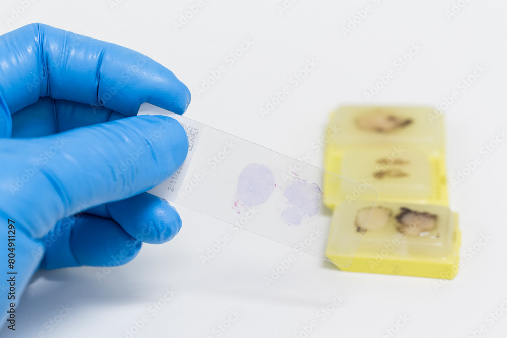 Scientist wear blue glove holding slide and out of focus paraffin human ...