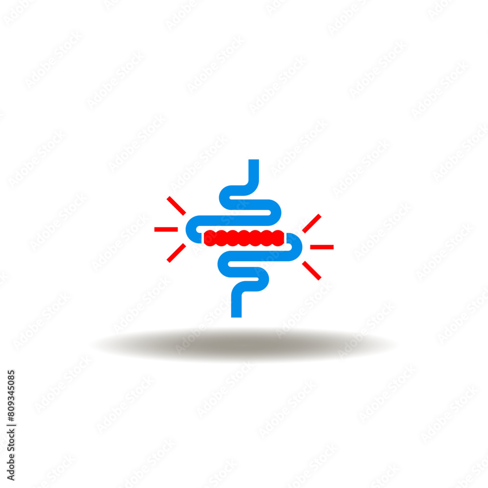 Vector illustration of intestine or bowel occlusion, obstruction ...