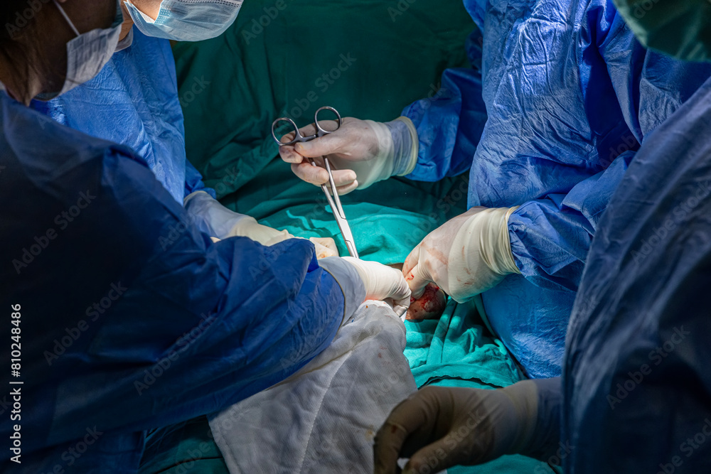 Surgeons performing cesarean section in operating room. Birth surgery ...