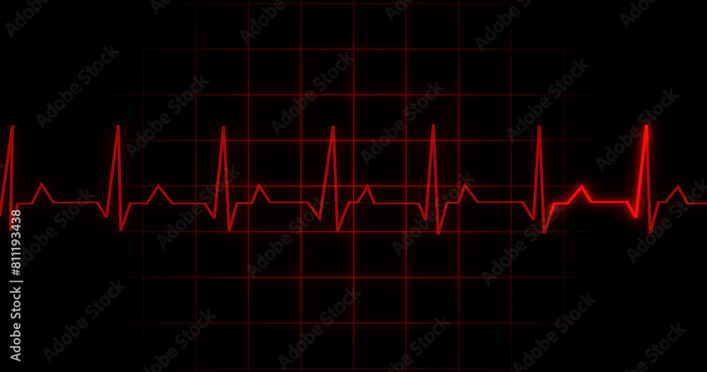 EKG Heartbeat reading animation on black background. Medical monitor ...