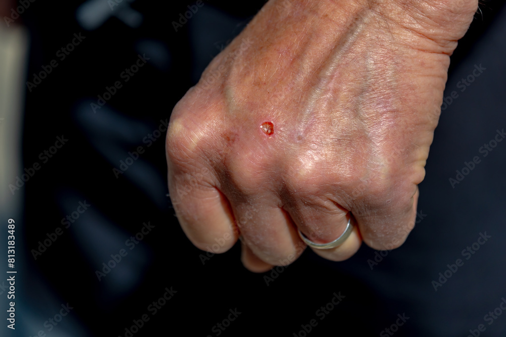 Healthcare and medical concept, A man with handful showing a little ...