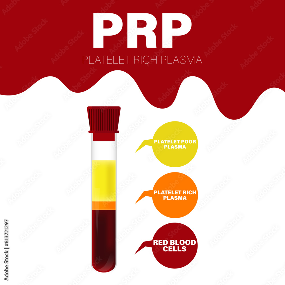 Vector illustration of test tube with blood after centrifugation of ...