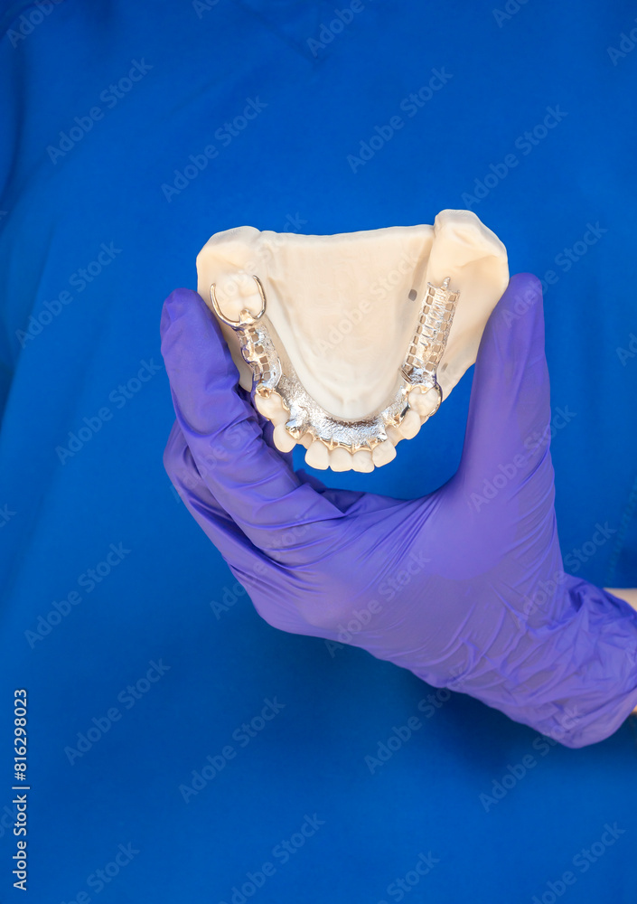 Dentist Holding Metal Frame Lower Partial Denture with Die Stone ...
