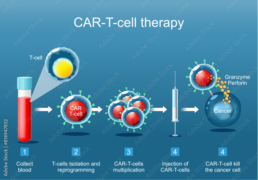 CAR T-cell therapy. cancer immunotherapy Stock Vector | Adobe Stock