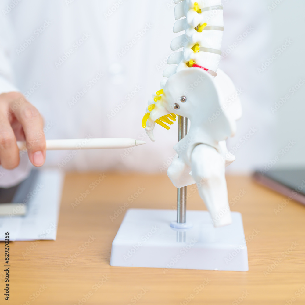 Doctor with human Spine anatomy model. Spinal Cord Disorder and disease ...