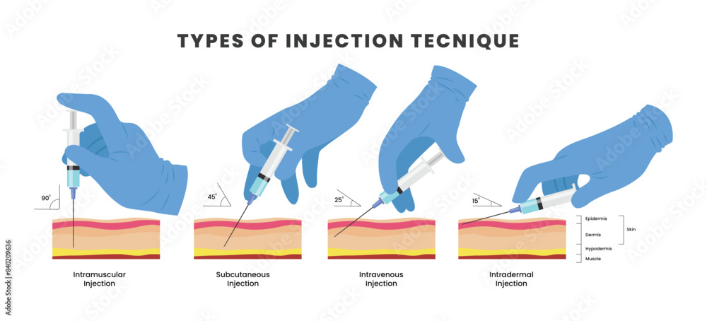 Different types of injection technique poster or medical banner scheme, with Various methods of ...